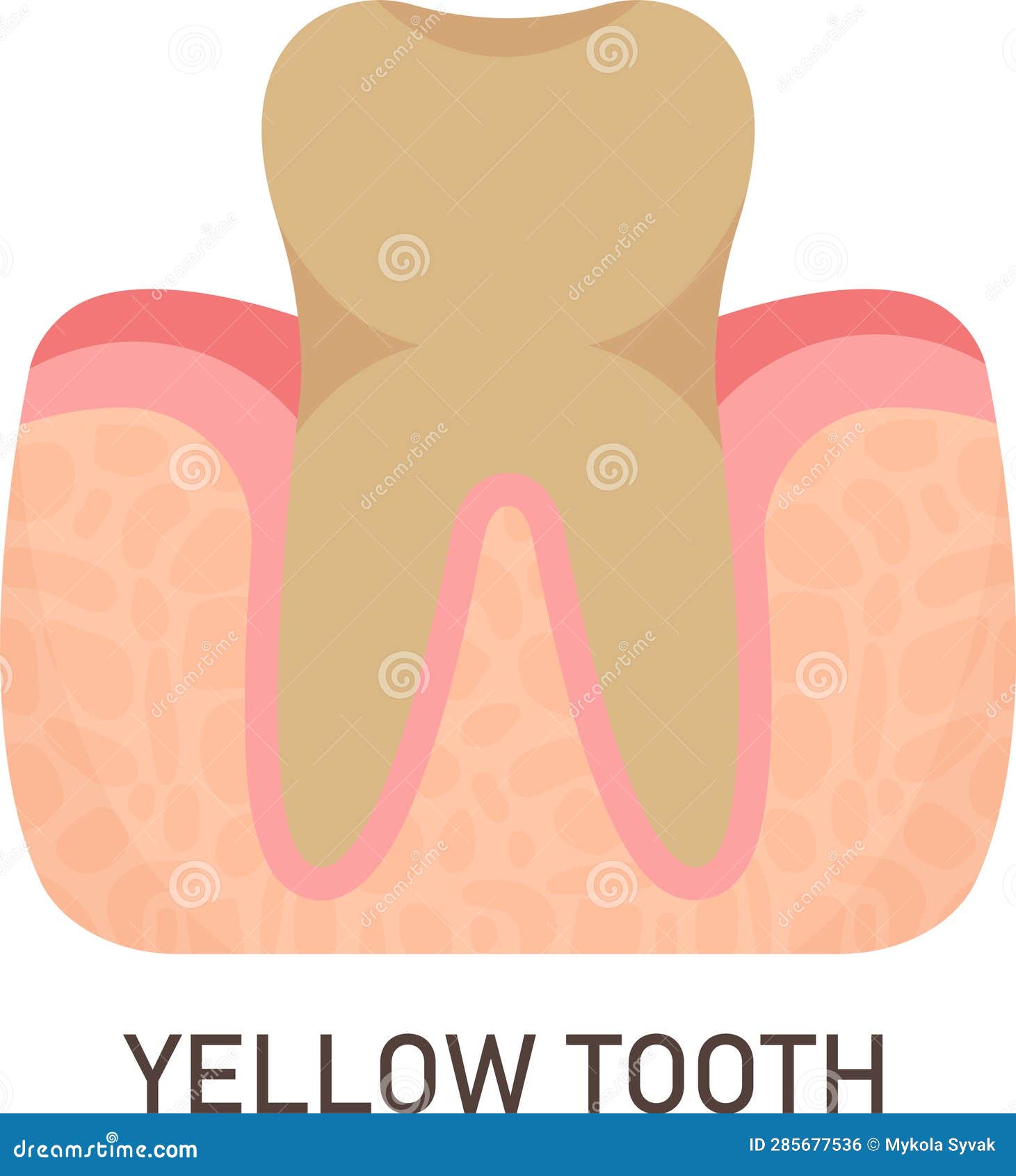Yellow Tooth Problem stock vector. Illustration of hygiene - 285677536