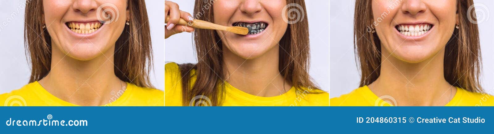 Yellow and White Teeth before and after Brushing. Black Charcoal ...