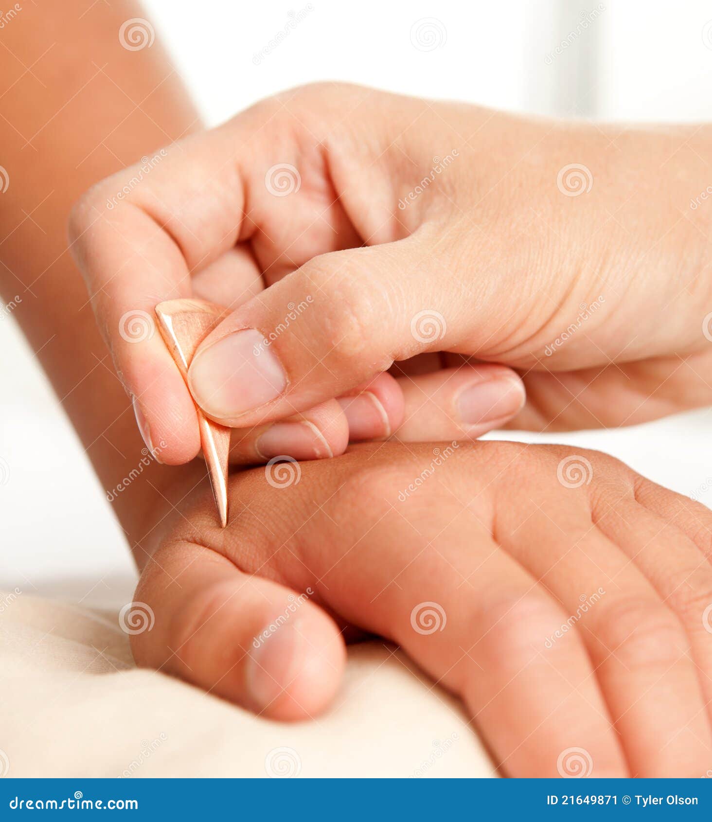 Yoneyama Shonishin Acupuncture Tool Stock Image - Image of alternative ...