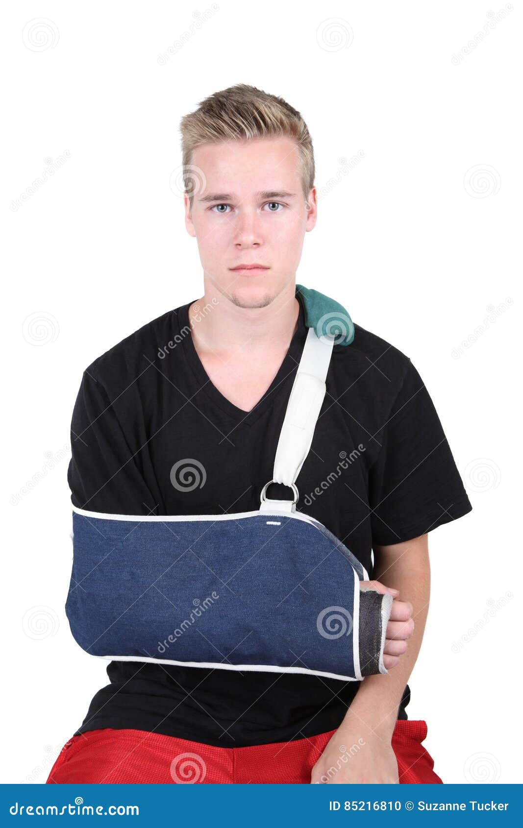 Young Adult with a Broken Hand Stock Photo - Image of hand, limb: 85216810