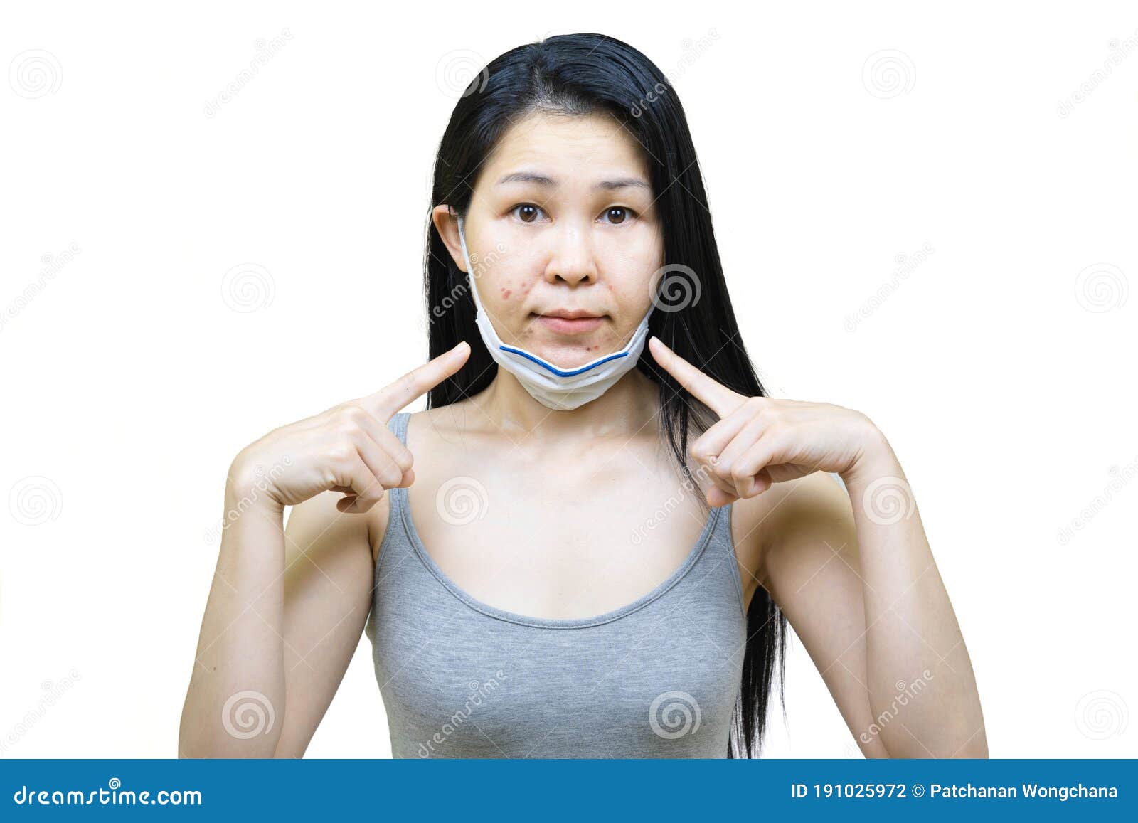 Young Asian Woman Wearing Medical Face Mask Her Hand Point At Pimple On Chinskin Allergyacne