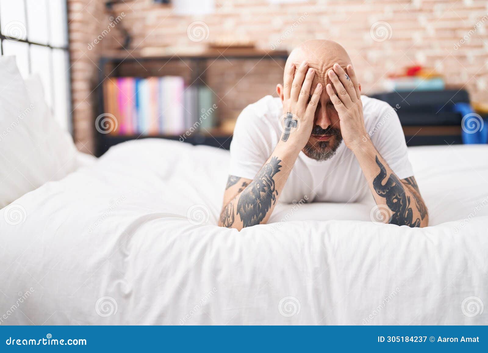 Young Bald Man Stressed Lying on Bed at Bedroom Stock Image - Image of ...
