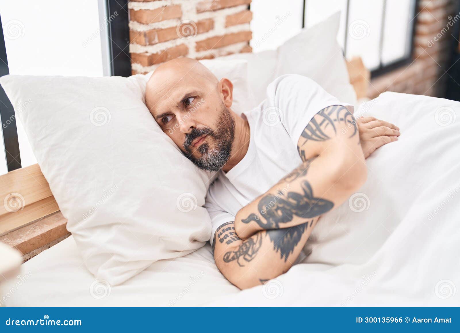 Young Bald Man Stressed Sitting on Bed at Bedroom Stock Photo - Image ...