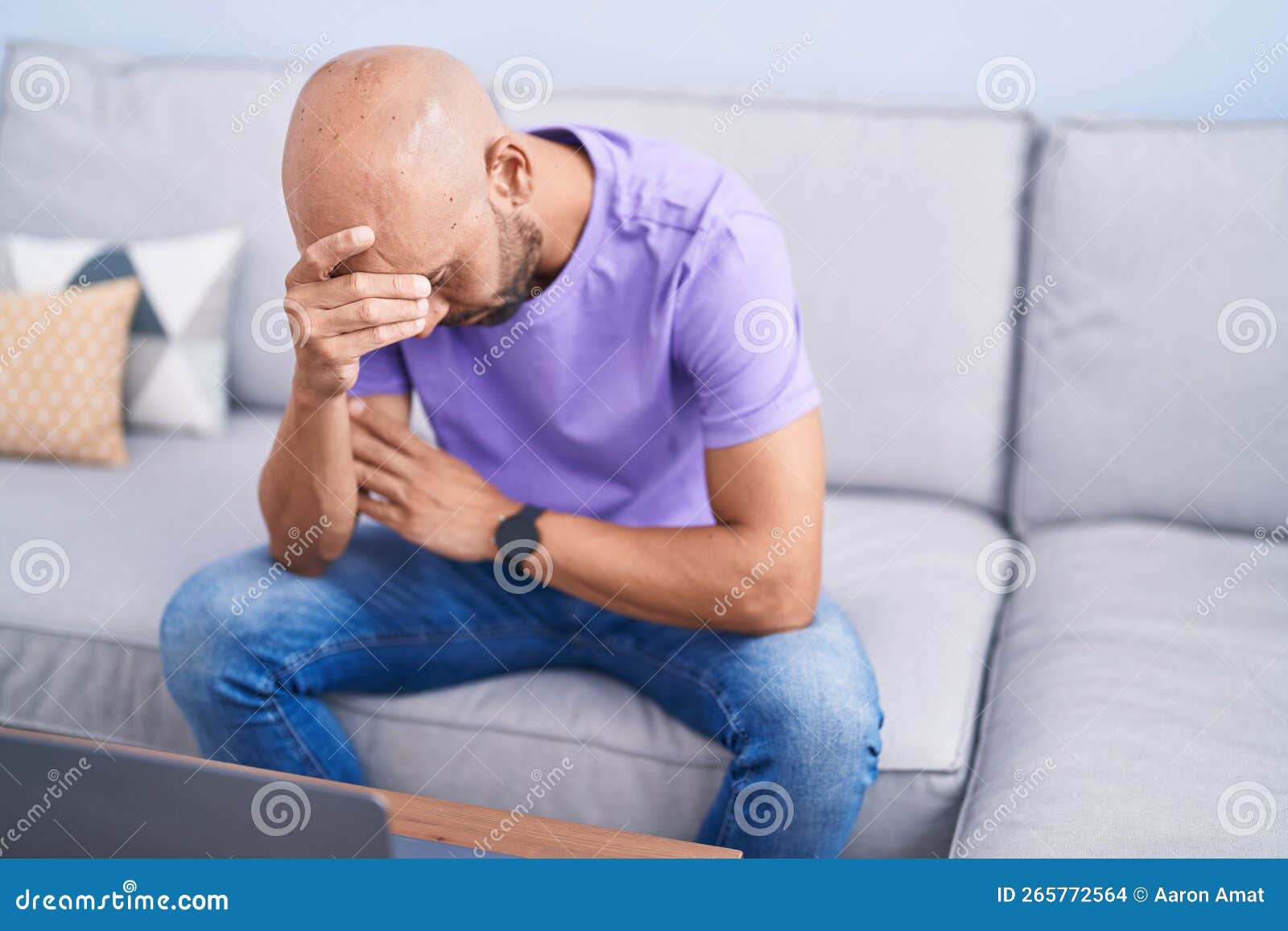 Young Bald Man Stressed Sitting on Sofa at Home Stock Photo - Image of ...
