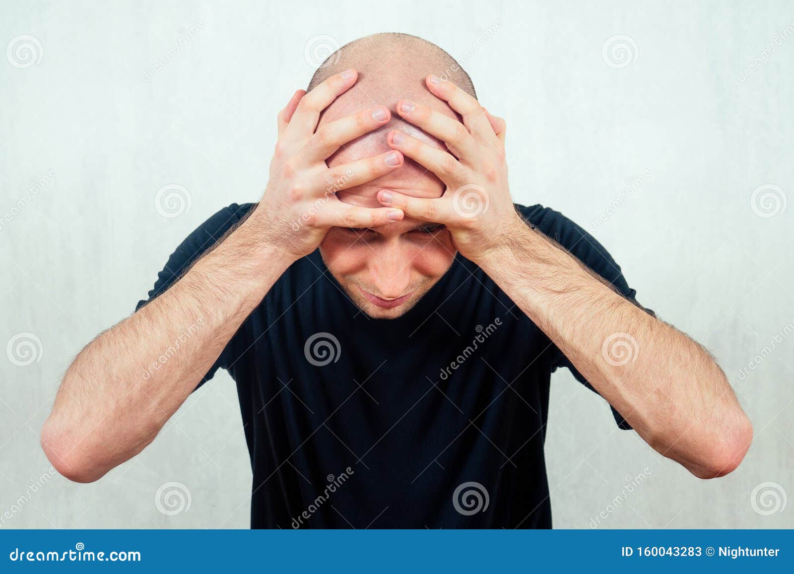 A Young Balding Bald Man Yells and Screams Holding His Head. the ... A Young Balding Bald Man Yells and Screams Holding His Head. the ...
