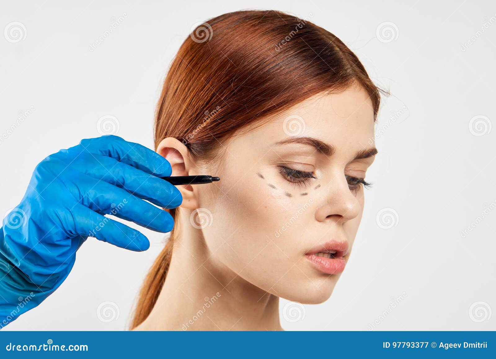 Young Beautiful Woman on White Background, Plastic Surgery, Portrait ...