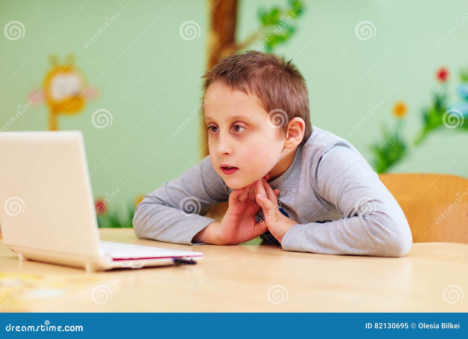 Young Boy with Special Needs Watching Video through the Laptop Stock ...