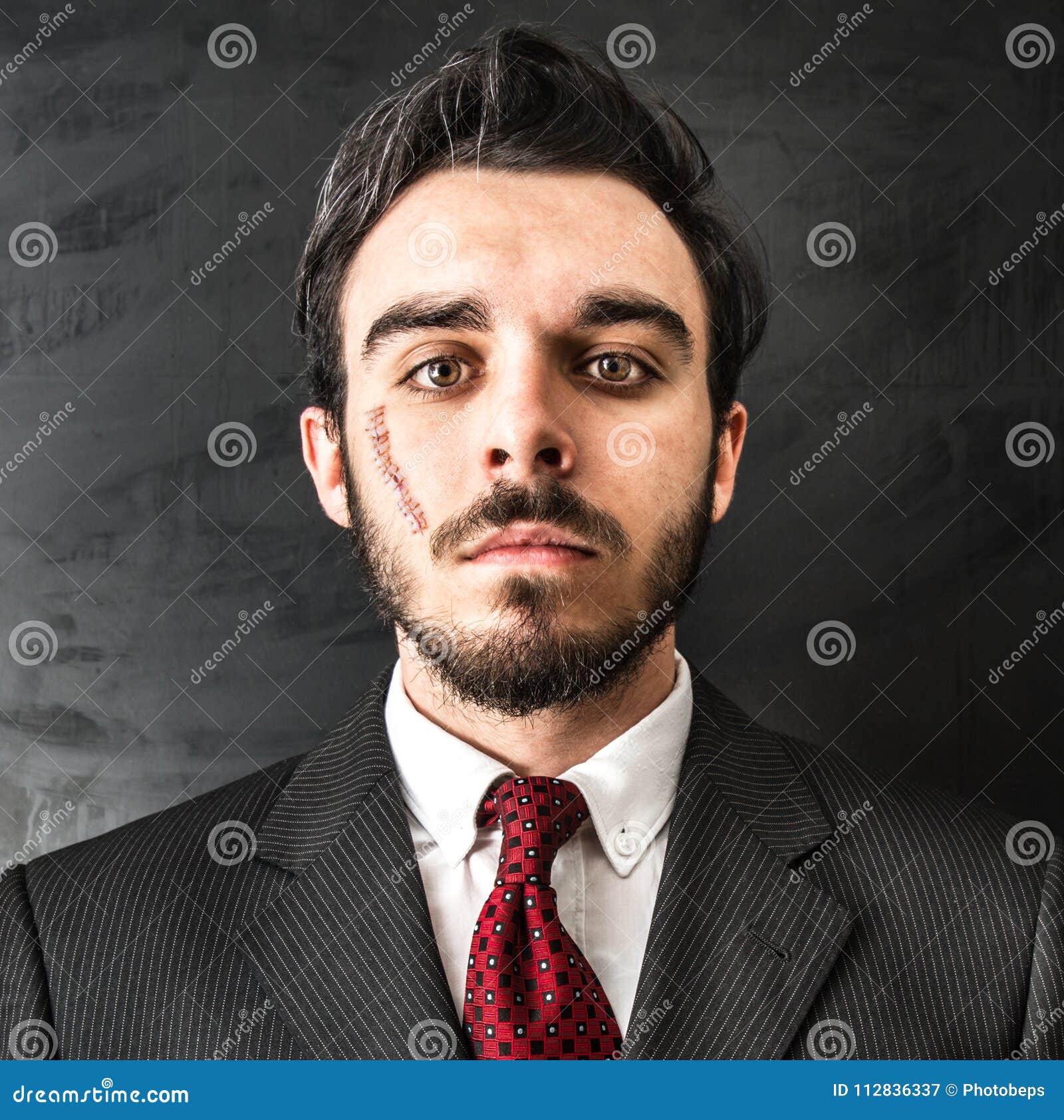 Scarface. A Young Man With A Big Scar On His Face Royalty-Free Stock ...