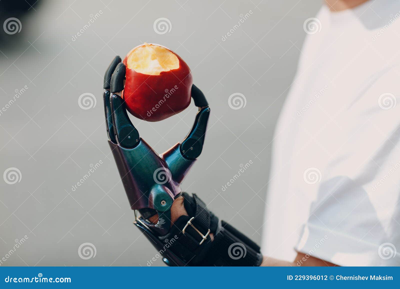 Young Disabled Man with Artificial Prosthetic Hand in Casual Clothes ...