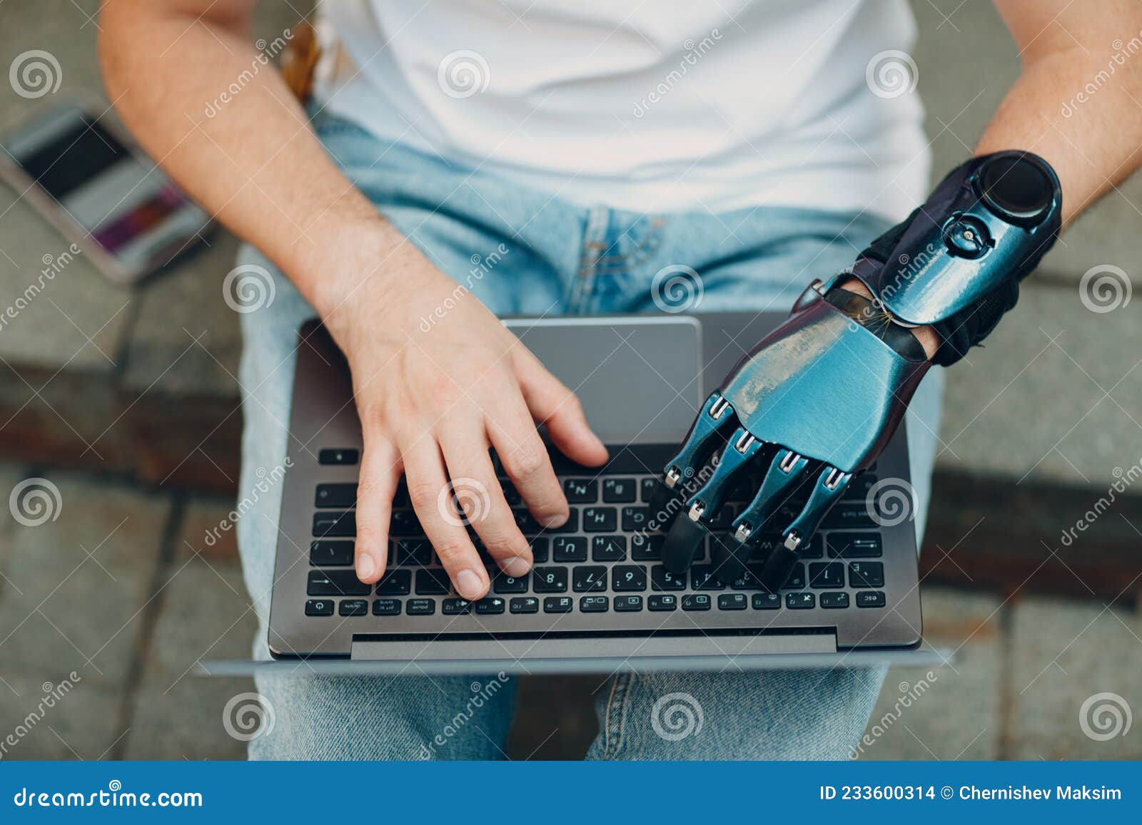 Young Disabled Man with Artificial Prosthetic Hand Using Typing on ...