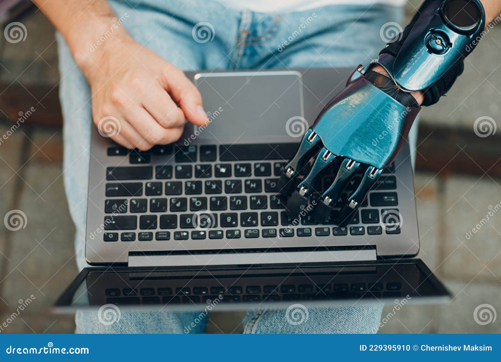 Young Disabled Man with Artificial Prosthetic Hand Using Typing on ...