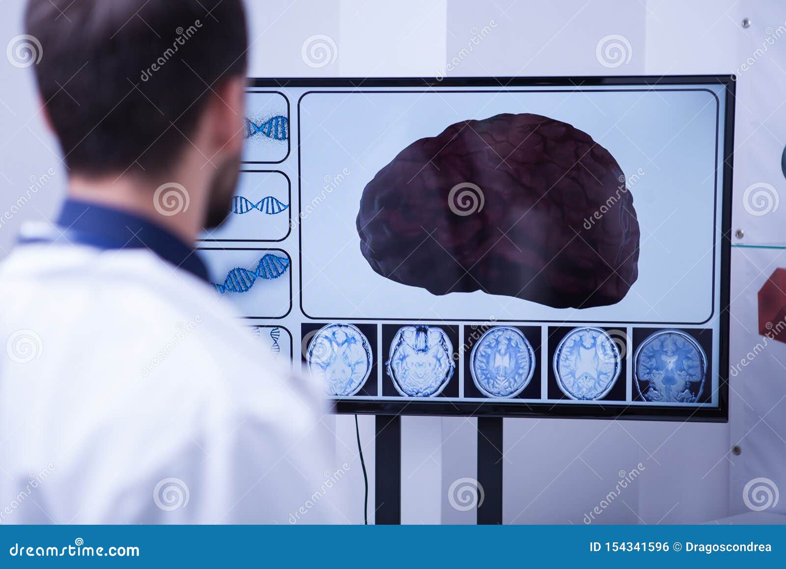 Young Doctor Checking a Brain after Nerve Surgery Stock Photo - Image ...