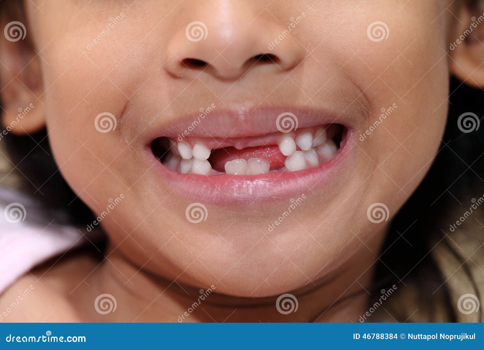 The Girl With The Missing Tooth Tooth Shows A Toy At Arm`s Length Stock ...