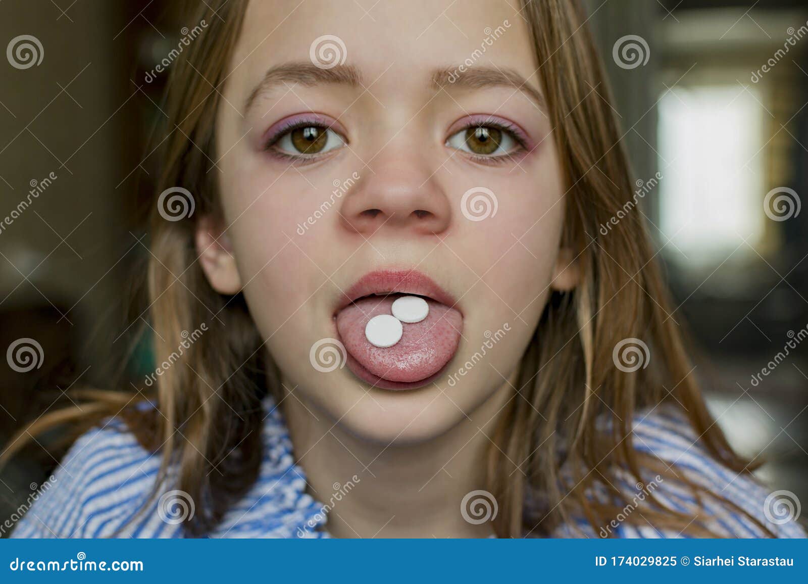A Young Girl Takes The Pills Stock Image Image Of Infections Side