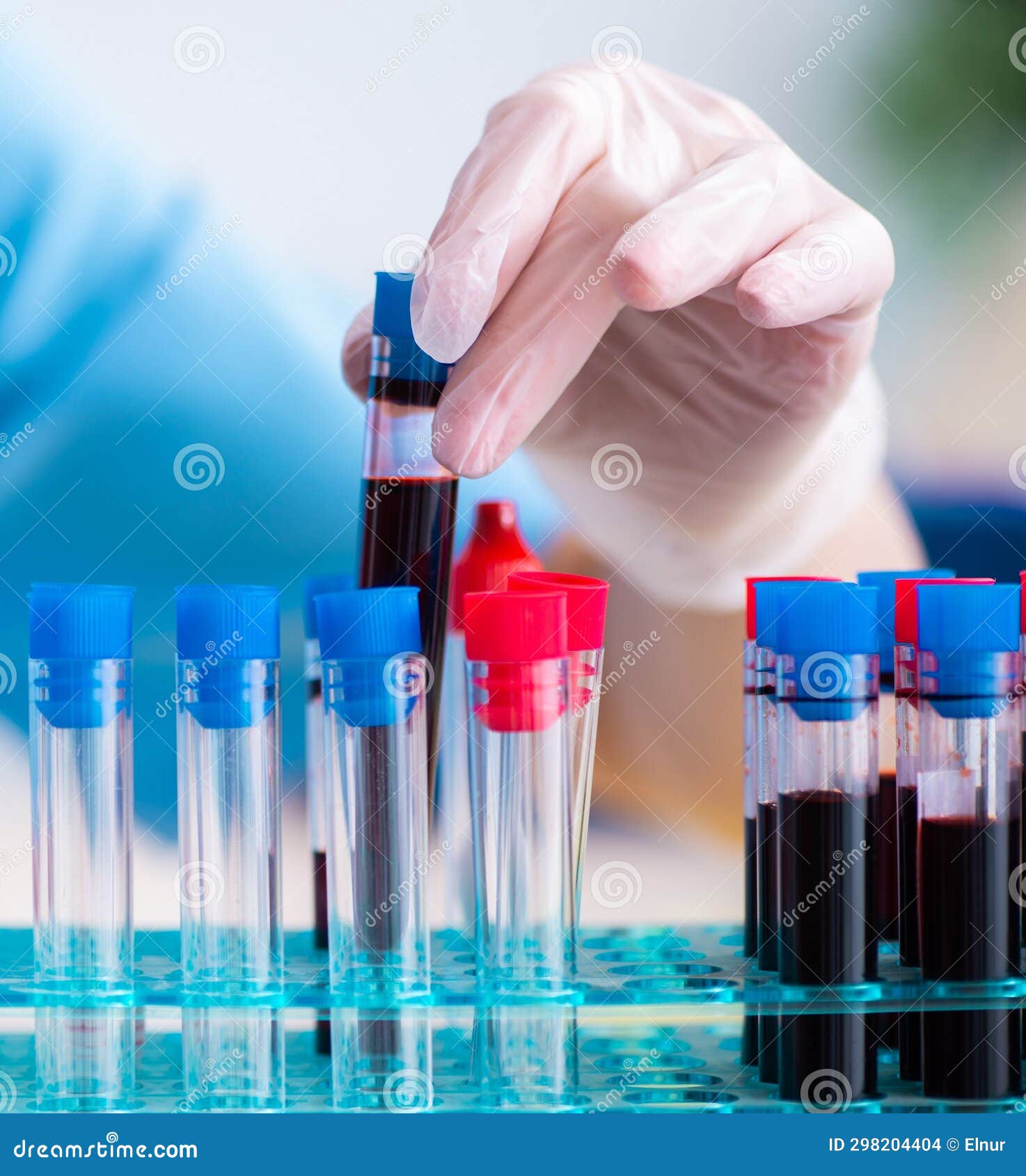 Young Lab Assistant Testing Blood Samples in Hospital Stock Photo ...