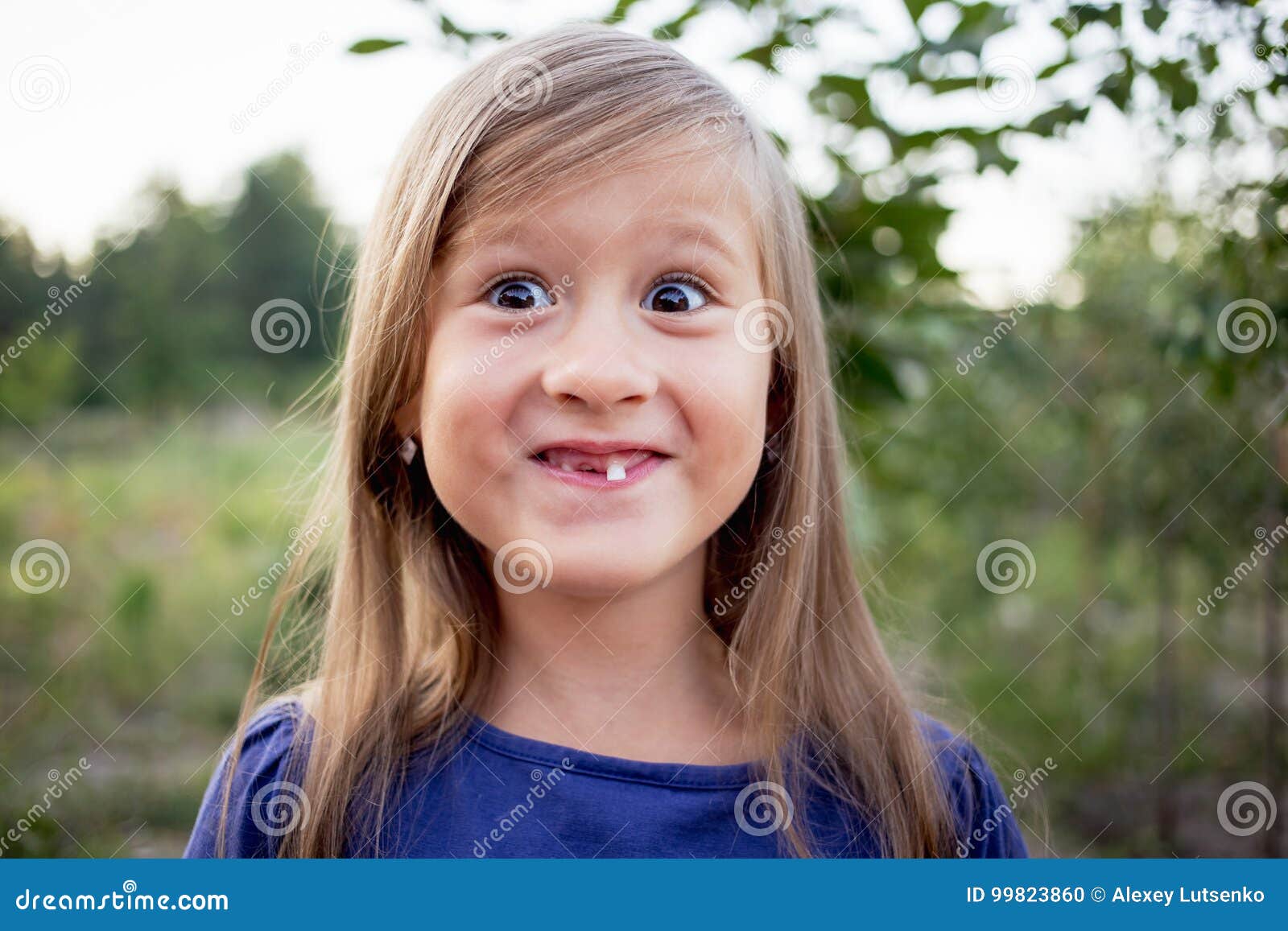 Young Little Girl without a Front Tooth Stock Photo - Image of ...