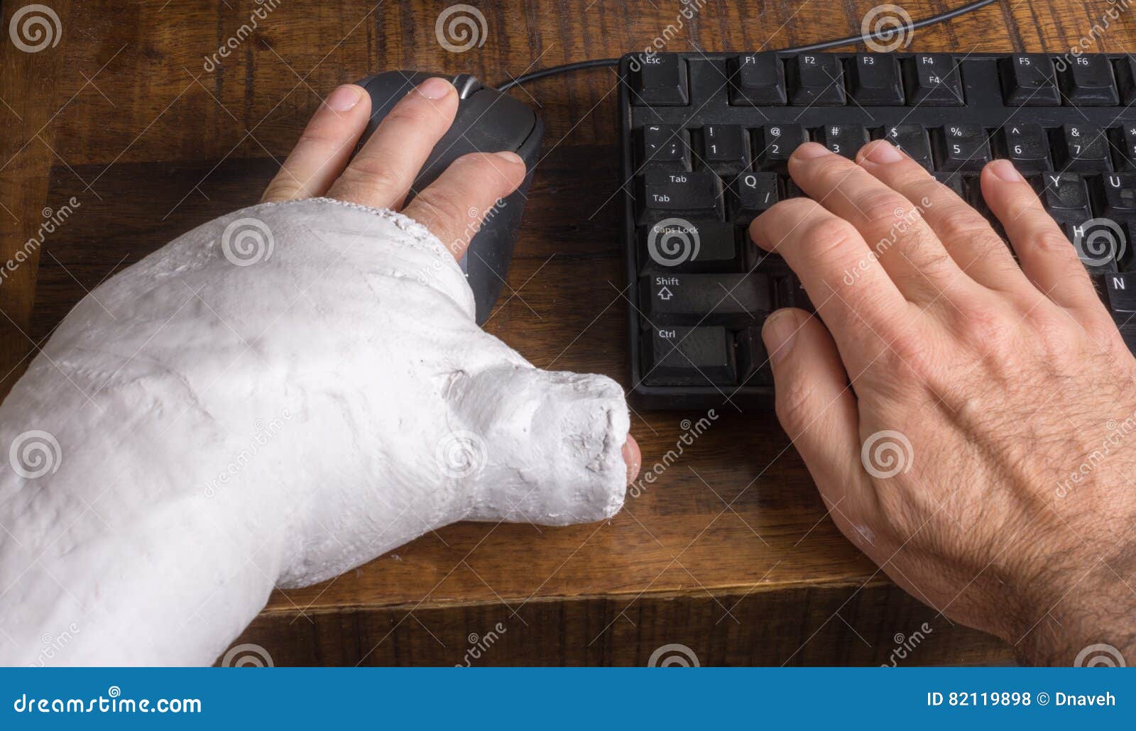 Young Man with Arm Cast Using a Computer Mouse Stock Photo - Image of ...
