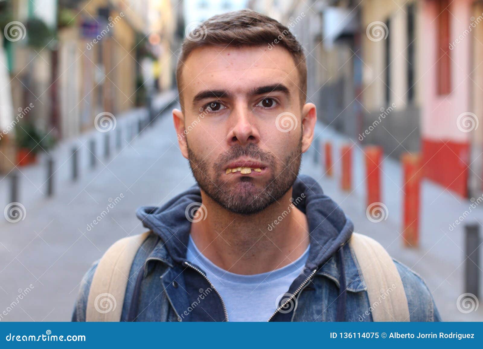 Young Man with really Bad Teeth Stock Image - Image of funny, comedy ...