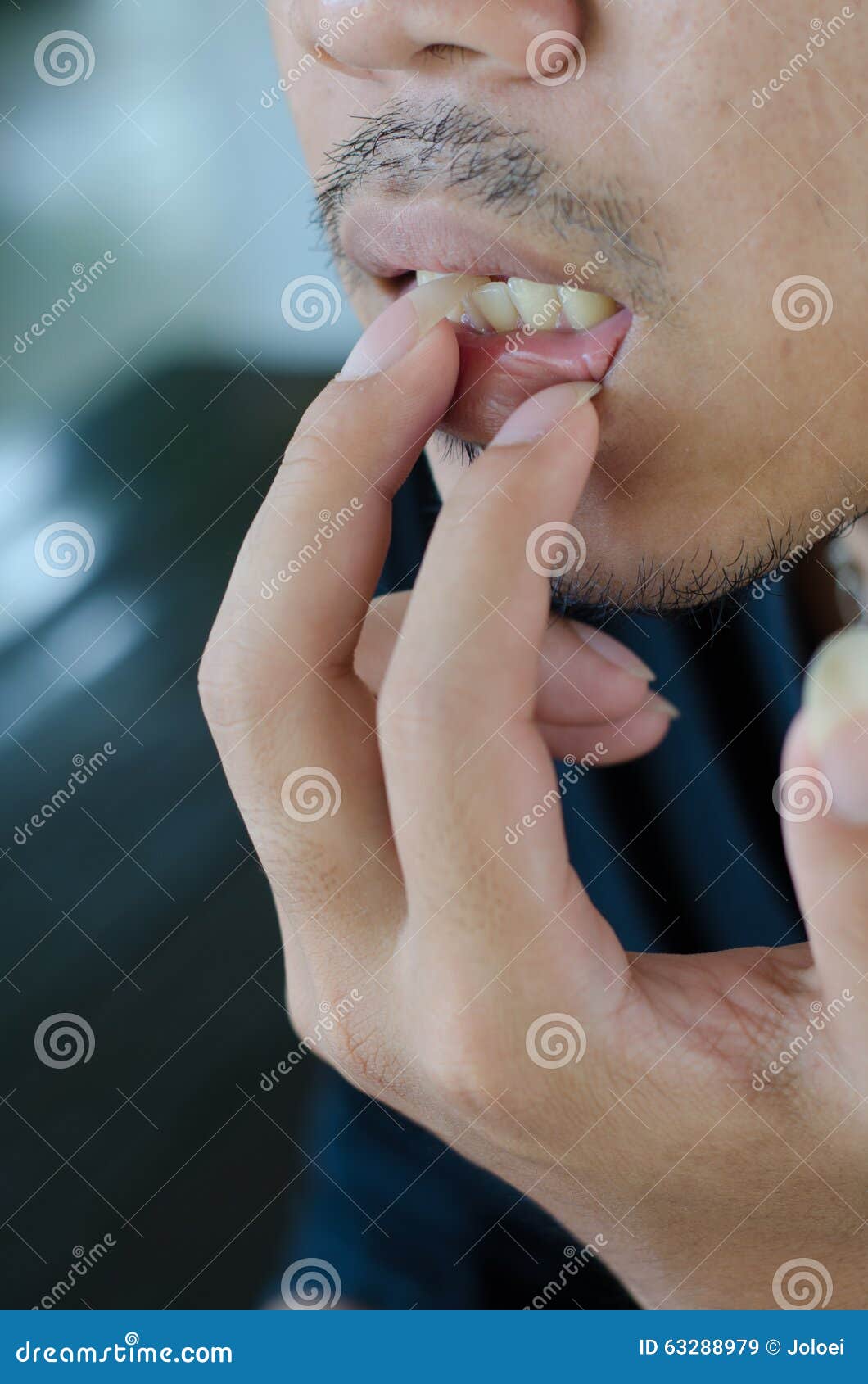 Young Man Biting Fingernail Stock Image - Image of stress, bite: 63288979