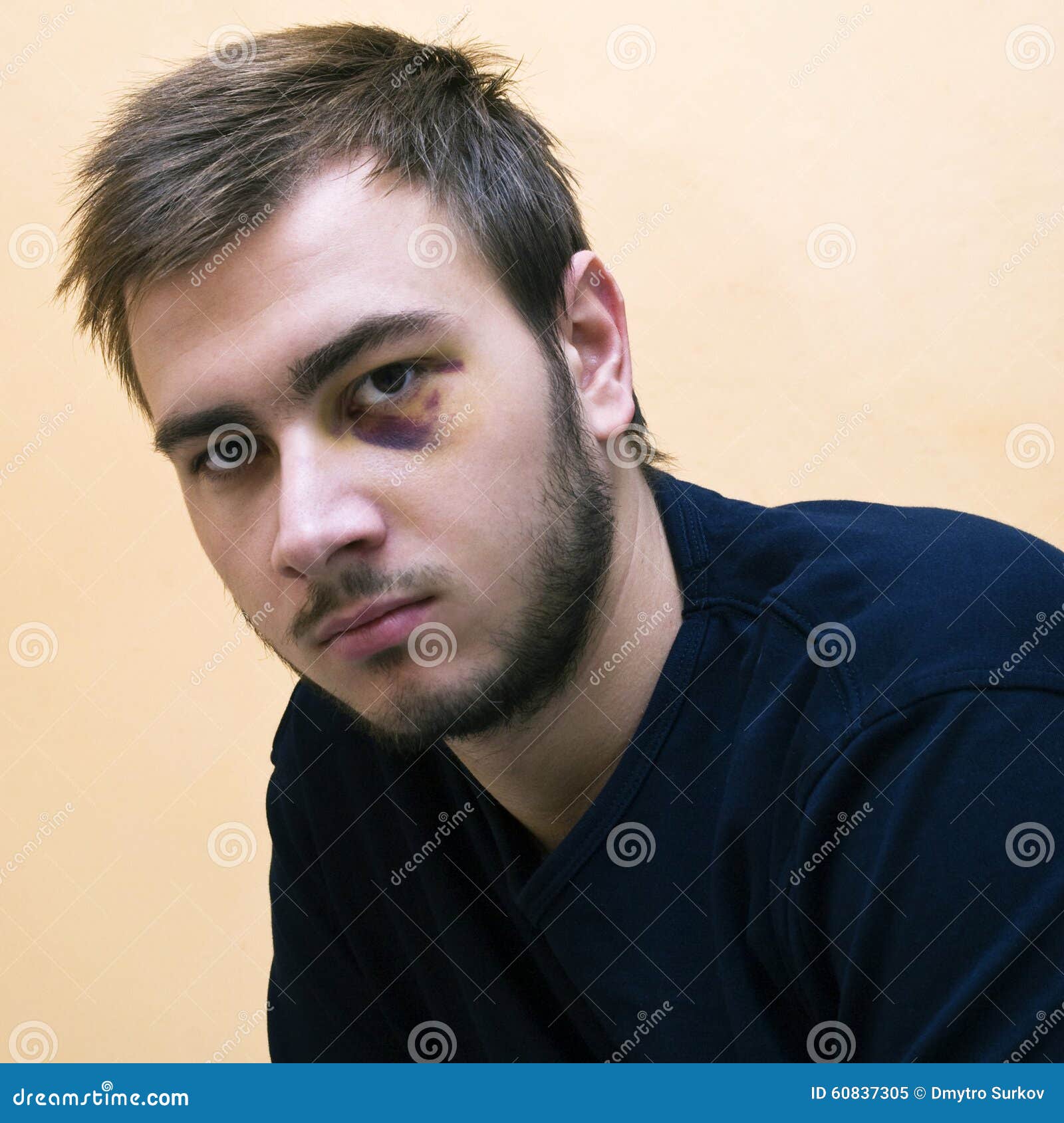 Young man with a black eye stock image. Image of aggression - 60837305