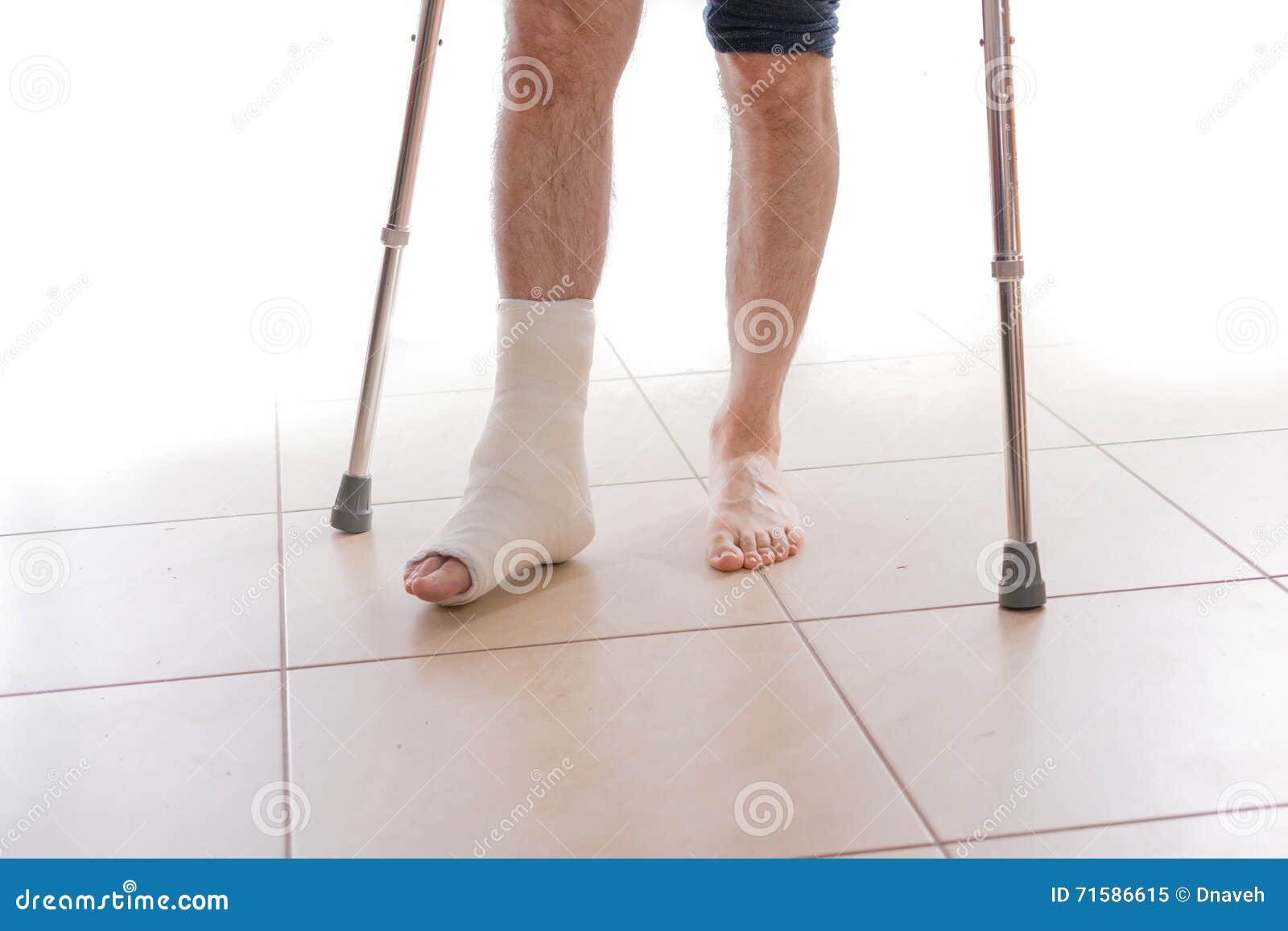 Young Man With A Broken Ankle And A Leg Cast Royalty-Free Stock Photo ...