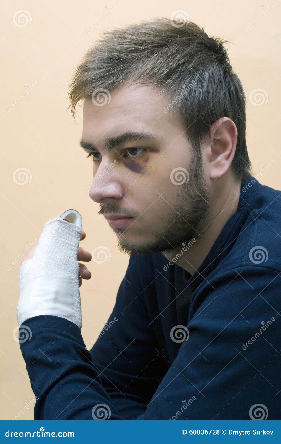 Young man with bruise stock photo. Image of injury, bandage - 60836728