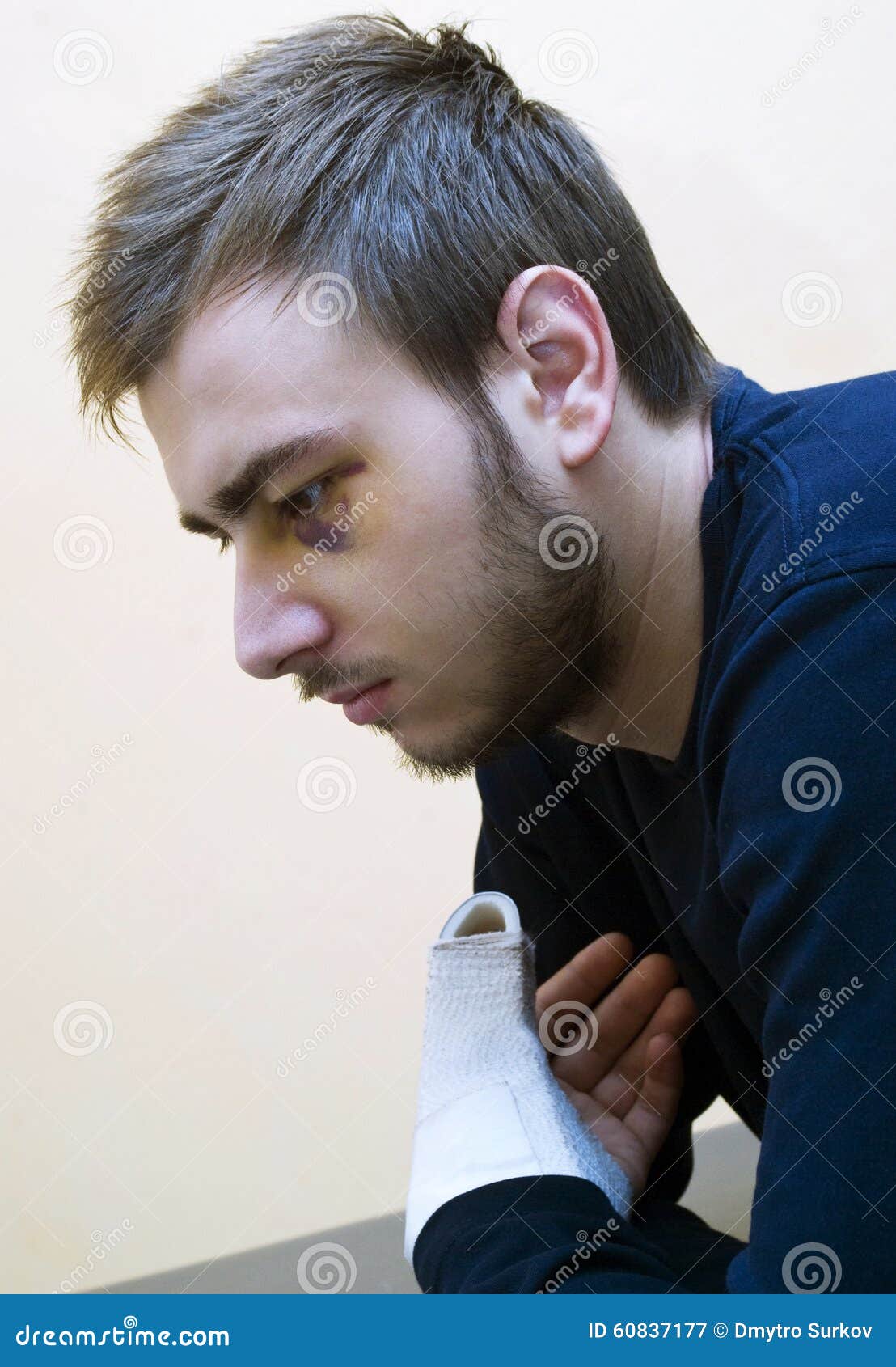 Young man with bruise stock image. Image of injury, facial - 60837177