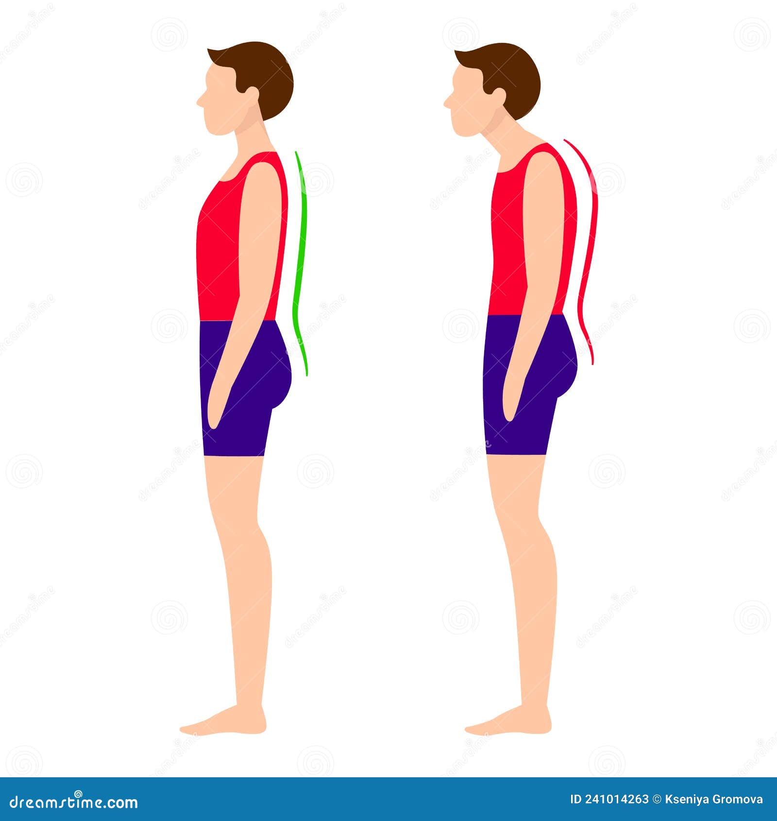 Posture, Bad, Spine, Pain, Back, Problem Concept. Hand Drawn Isolated ...