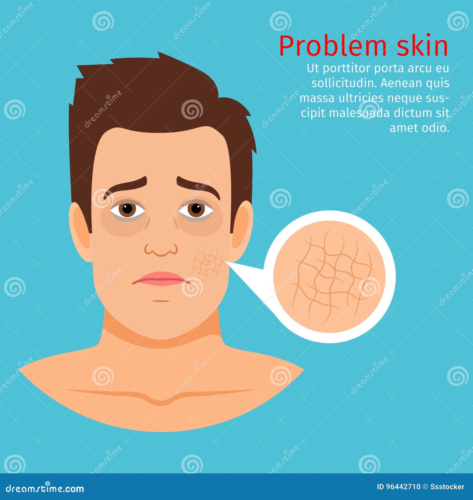 Young Man Face Dry Skin Problem Stock Vector - Illustration of ...