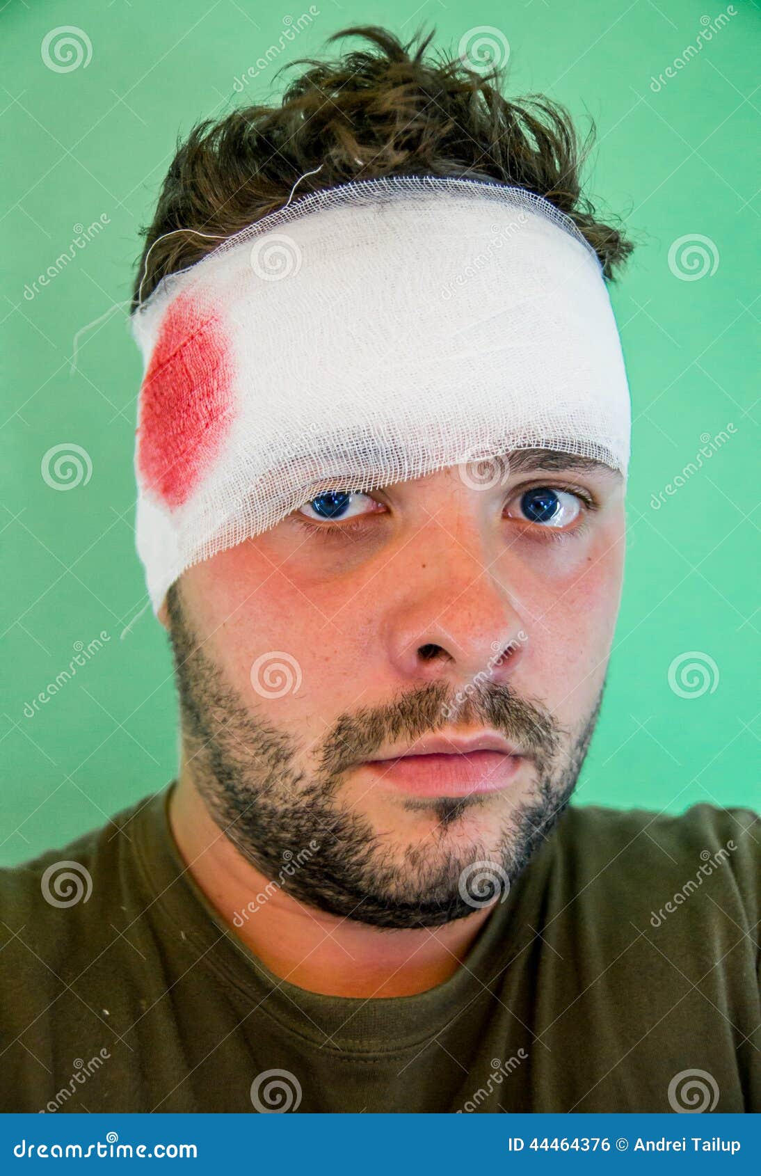 785 Forehead Injury Stock Photos - Free & Royalty-Free Stock Photos ...
