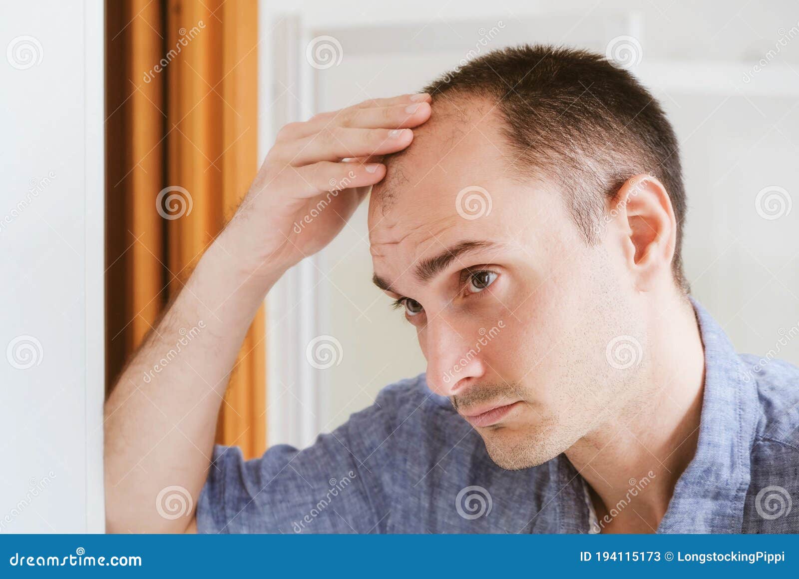 A Young Balding Bald Man Yells And Screams Holding His Head. The ... A Young Balding Bald Man Yells And Screams Holding His Head. The ...
