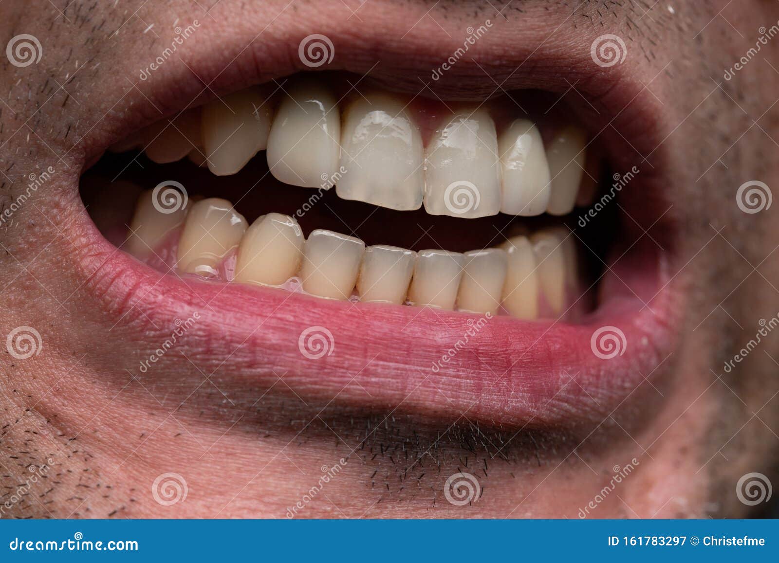 Young Man with Open Mouth, Showing Teeth Stock Image - Image of macro ...