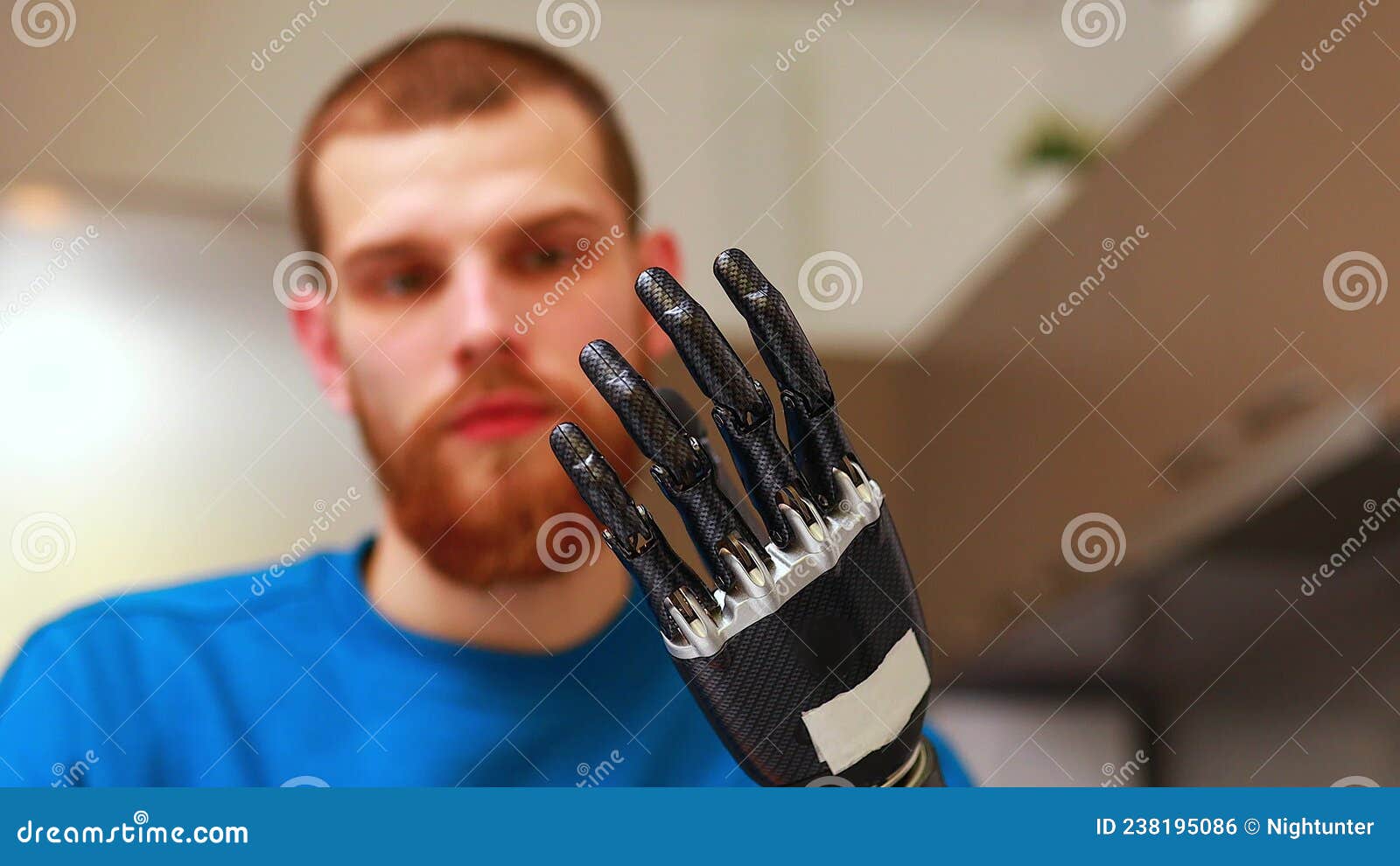 Young Man with Robotics Mechanical Modern Bionic Hand in Home Stock ...