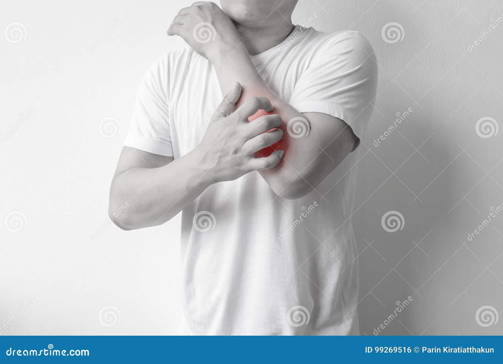 Man Scratch the Itch with Hand Stock Photo - Image of rash, dermatitis ...