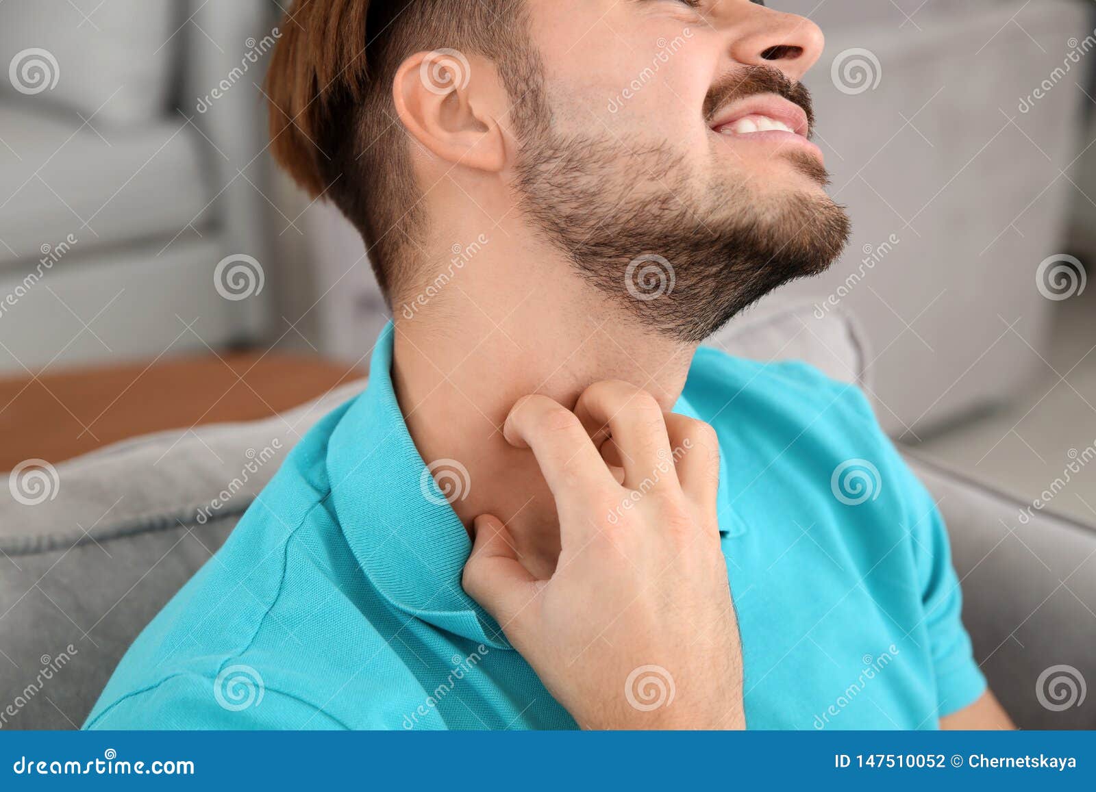 Young Man Scratching Neck. Annoying Itch Stock Photo - Image of hygiene ...