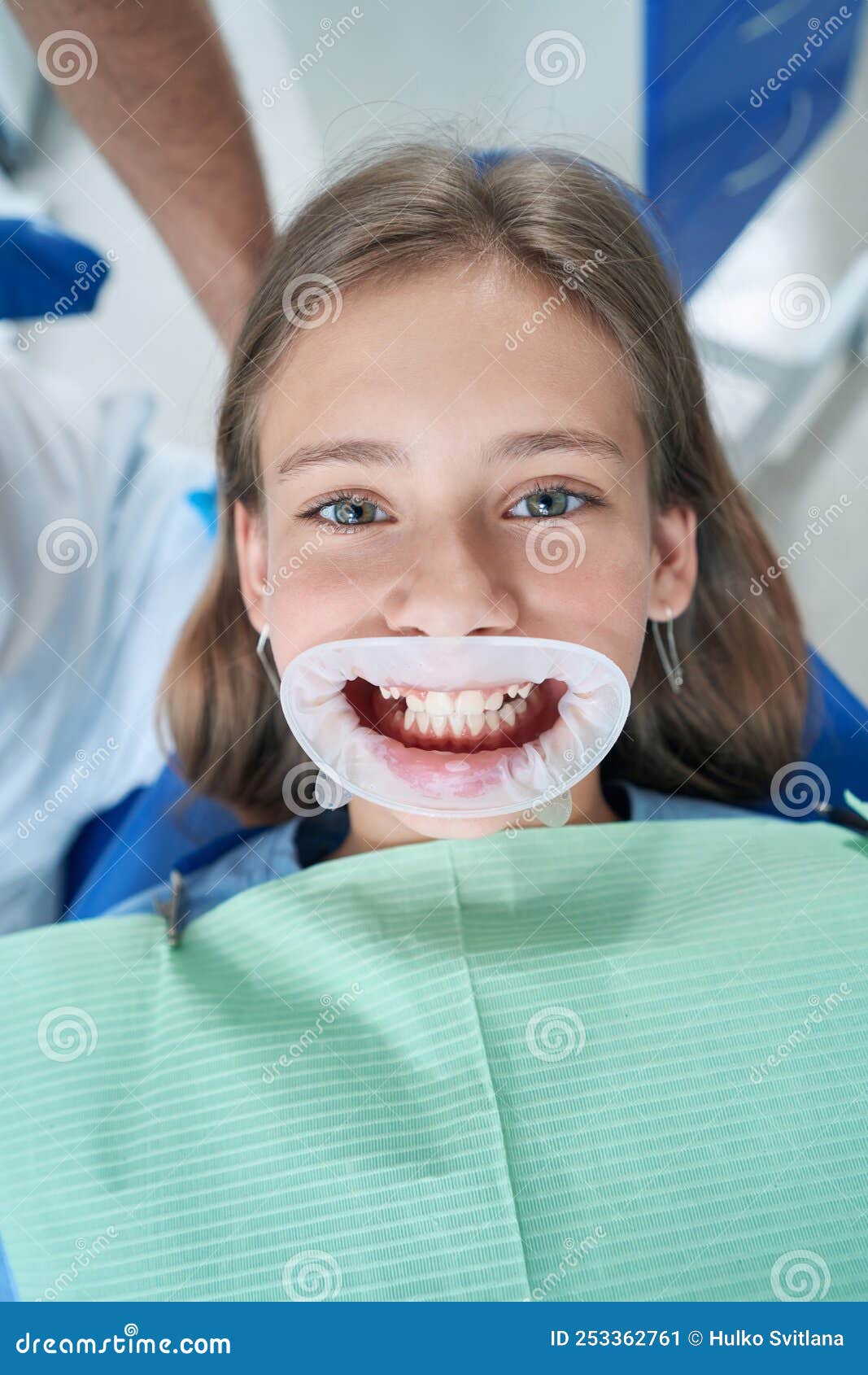 Young Patient With Dental Mouth Opener Before Medical Examination Stock Image Image Of Modern