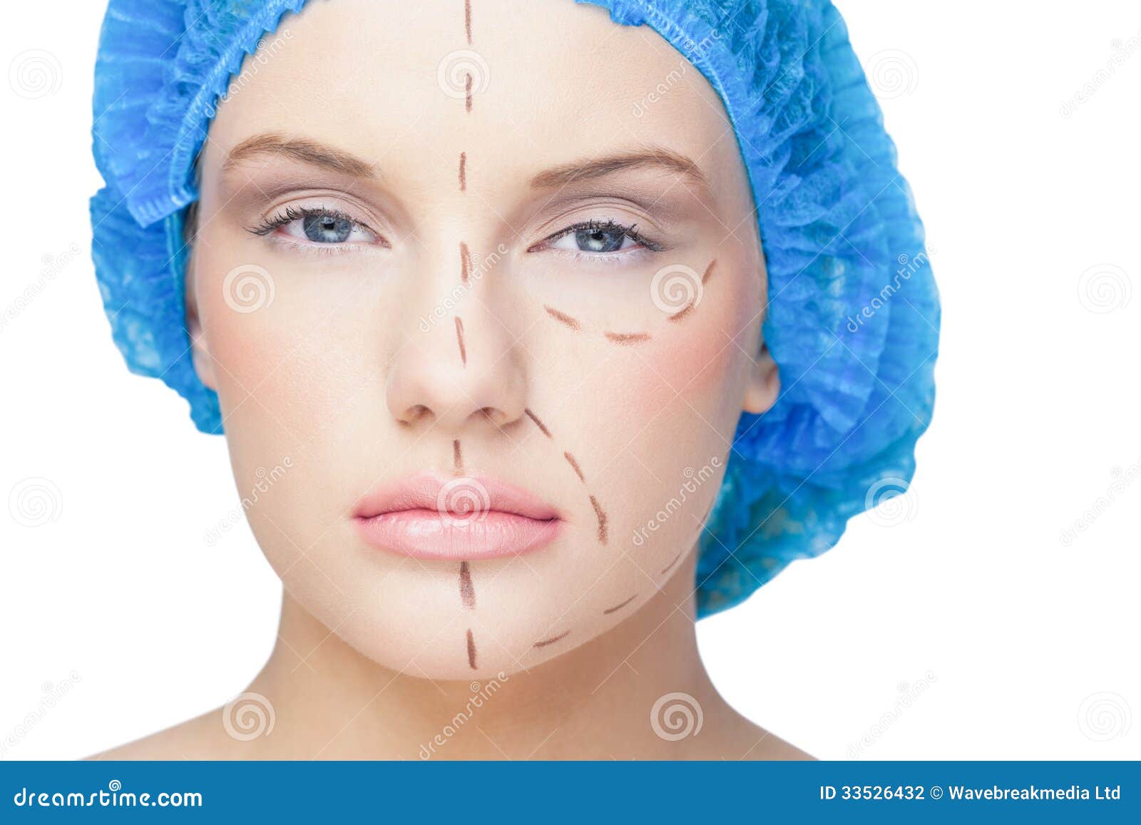 Young Patient with Dotted Lines on the Face Stock Photo - Image of ...