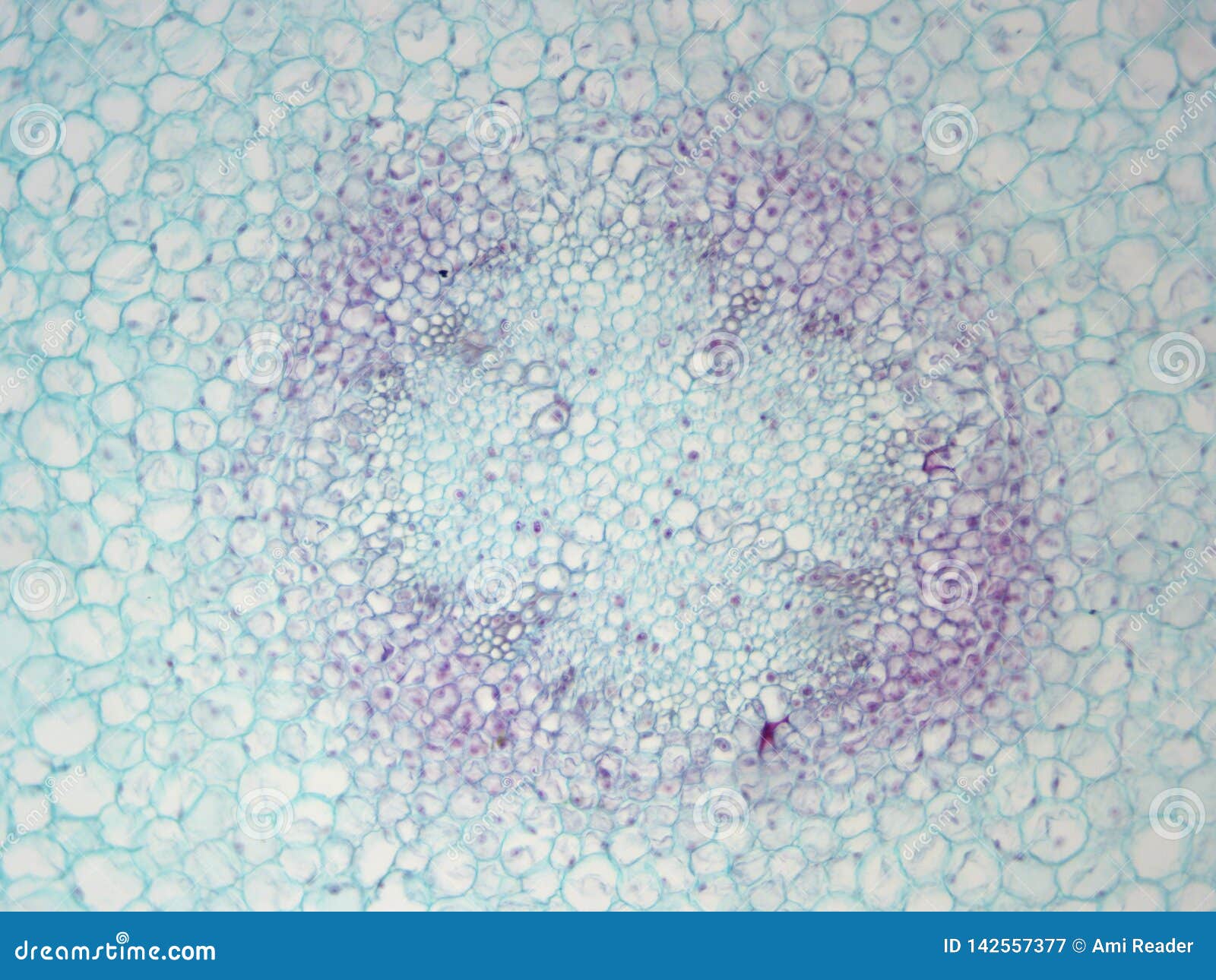 Young Root of Broad Bean 100x Center Stock Image - Image of structure ...