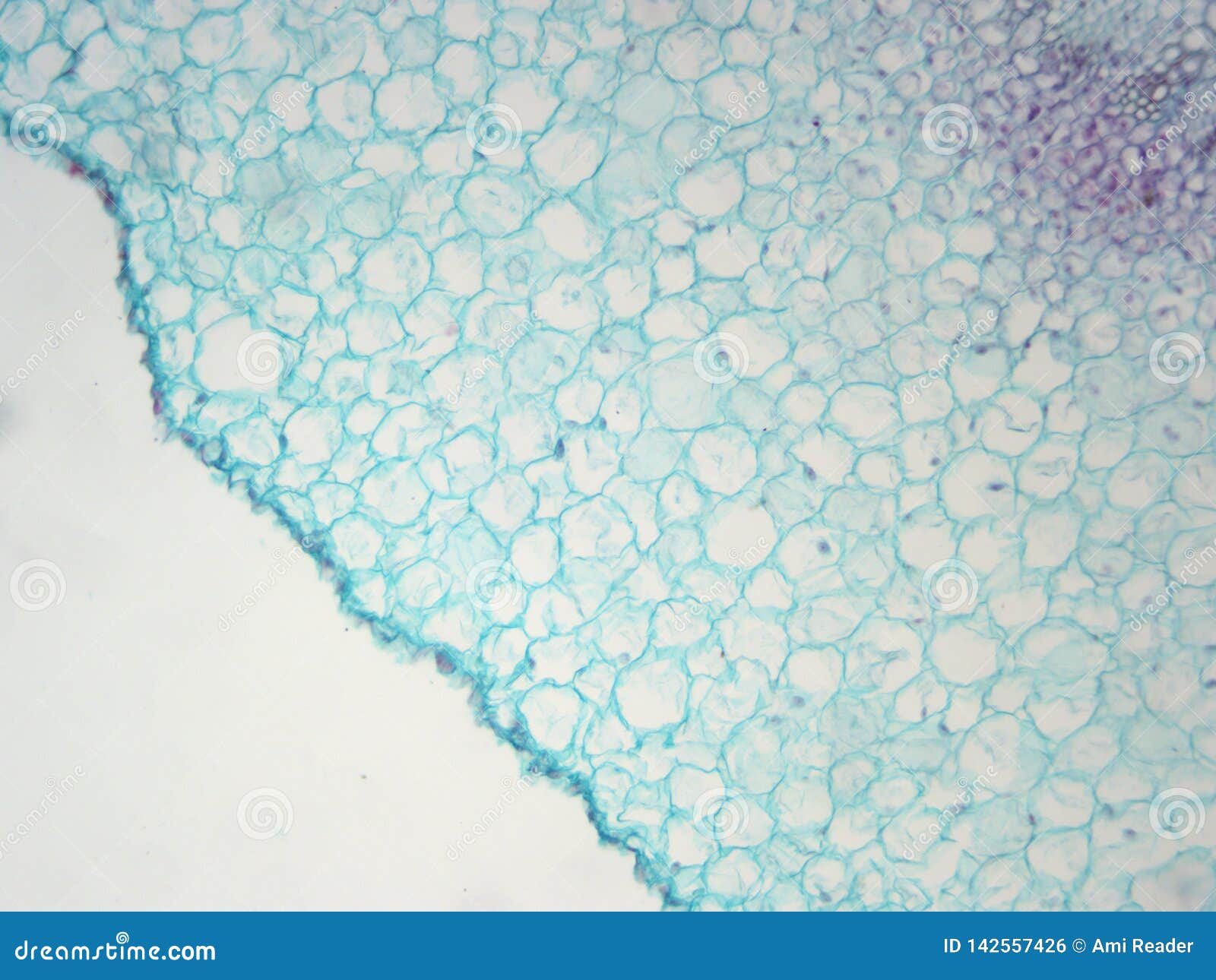 Young Root of Broad Bean Edge 100x Stock Photo - Image of blue, broad ...