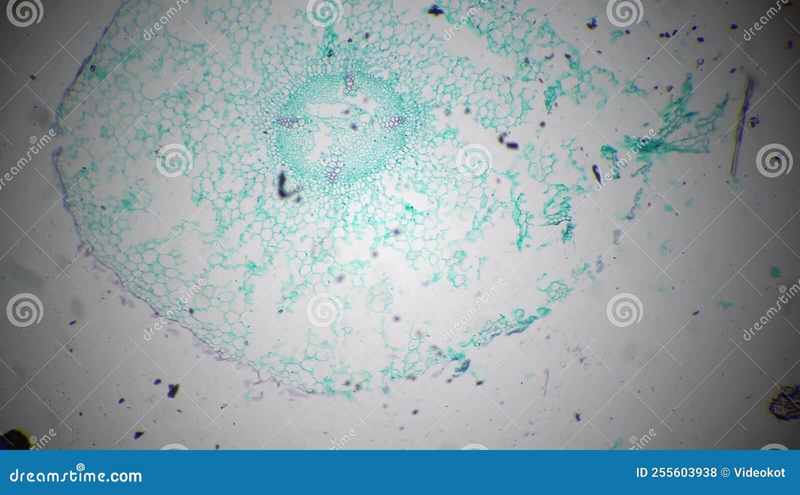Young Root of a Plant in Transversal Section Seen through Microscope ...
