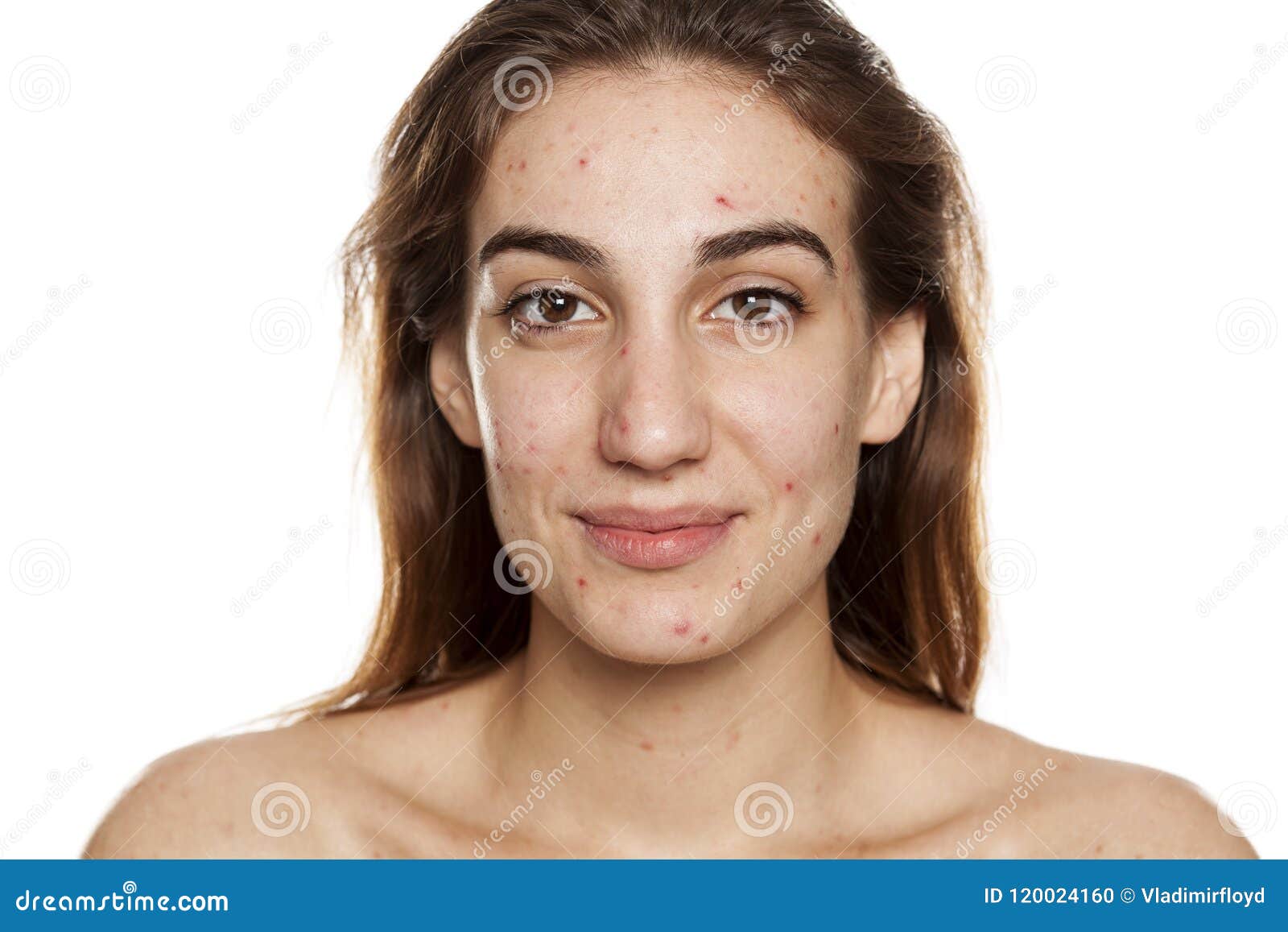 Problematic skin stock photo. Image of facial, beauty - 120024160