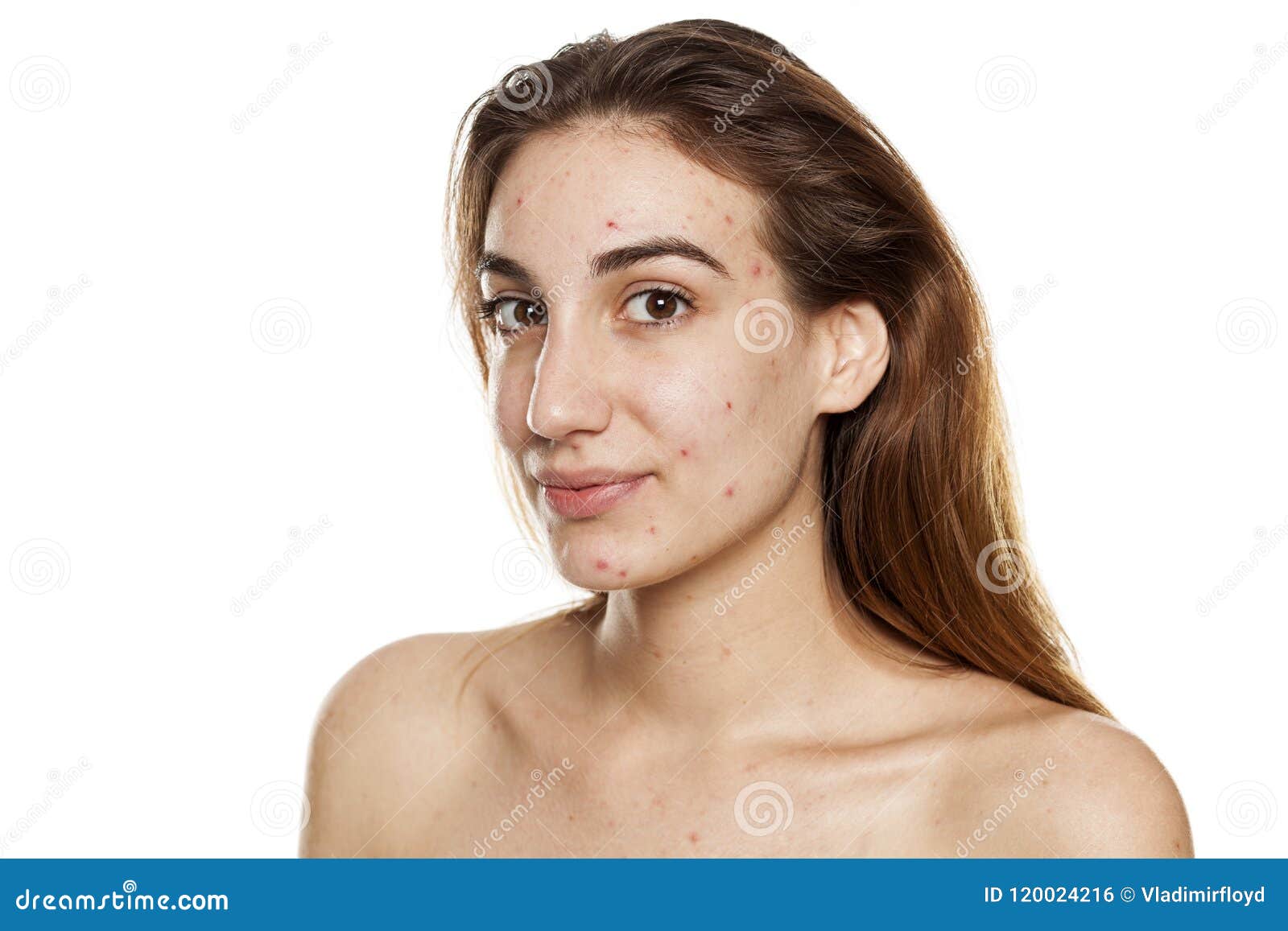 Problematic skin stock photo. Image of smile, female - 120024216