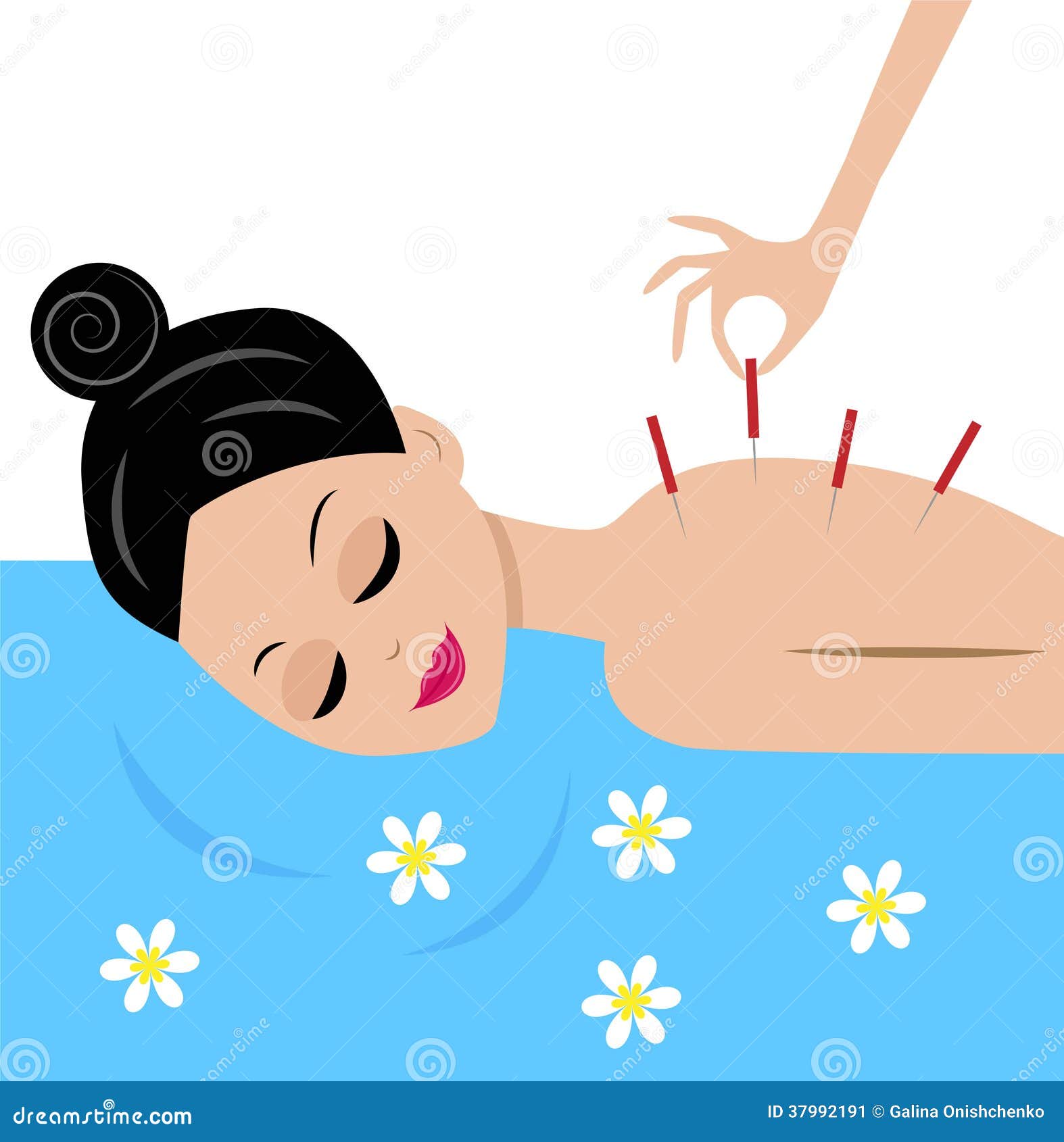 Young Woman Accept Procedure Acupuncture Stock Vector - Illustration of ...
