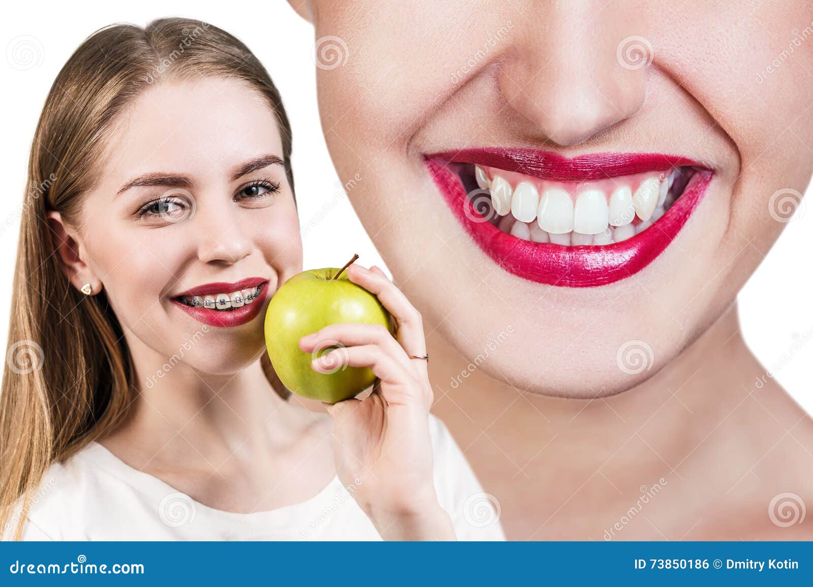 Young Woman with Brackets on Teeth Eating Apple Stock Photo - Image of ...
