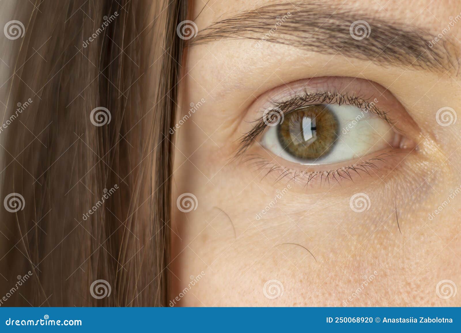 Young Woman with Eyelash Loss Problem. Macro Stock Photo - Image of ...
