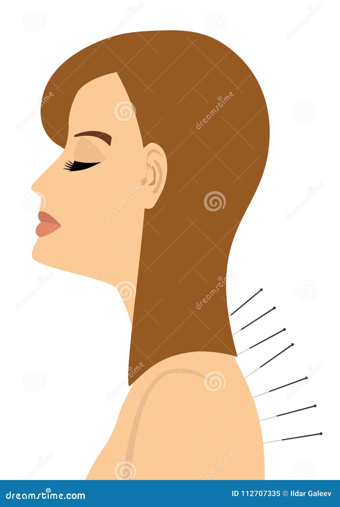 Young Woman Getting an Acupuncture Therapy with Needles in Back Stock ...