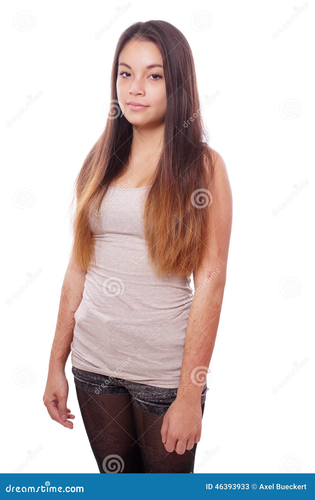 Young Woman with Scars from Self-harm Stock Image - Image of body ...