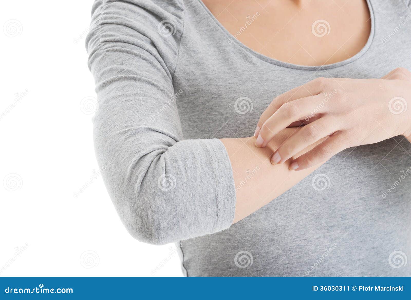 Young Woman is Scratching Herself on Arm. Stock Image - Image of ...