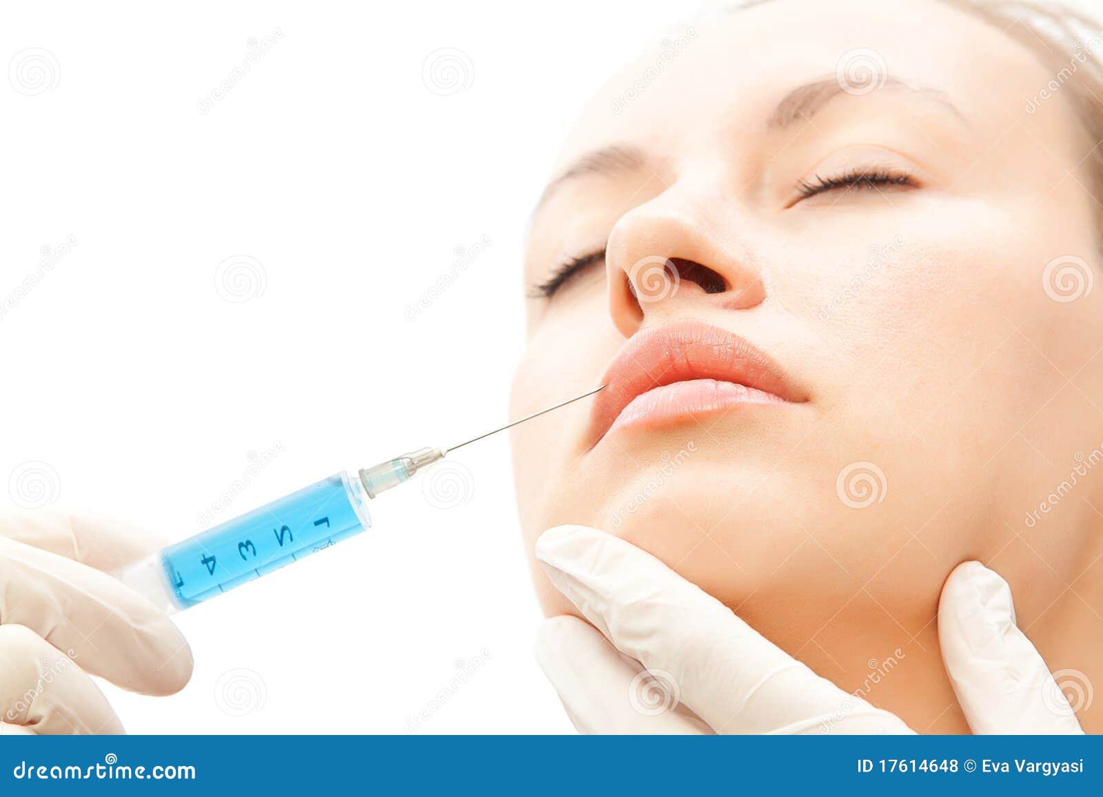 Young Women Injecting with Botox Stock Photo - Image of botoxreg ...