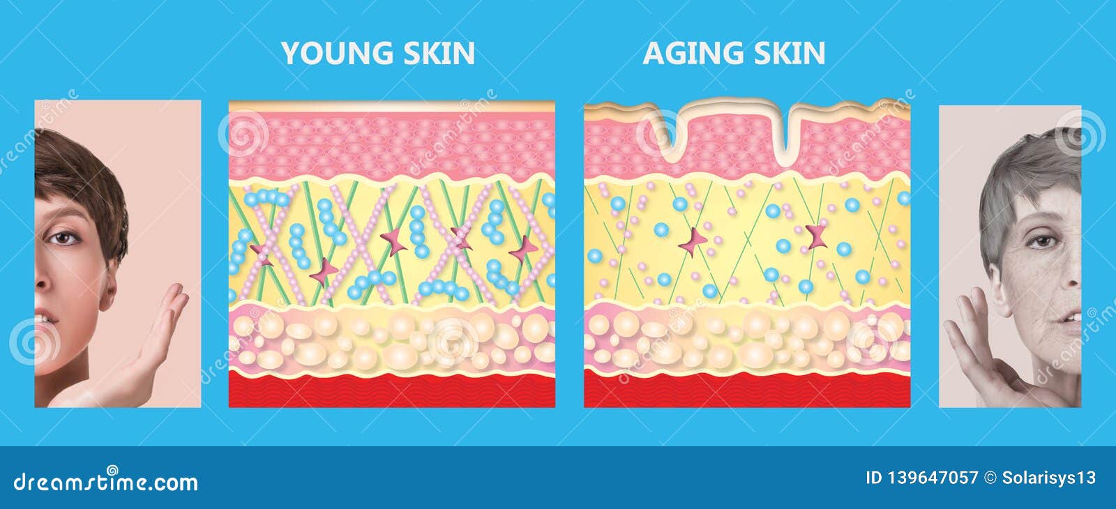 Younger Skin and Aging Skin. Elastin and Collagen Stock Image - Image ...